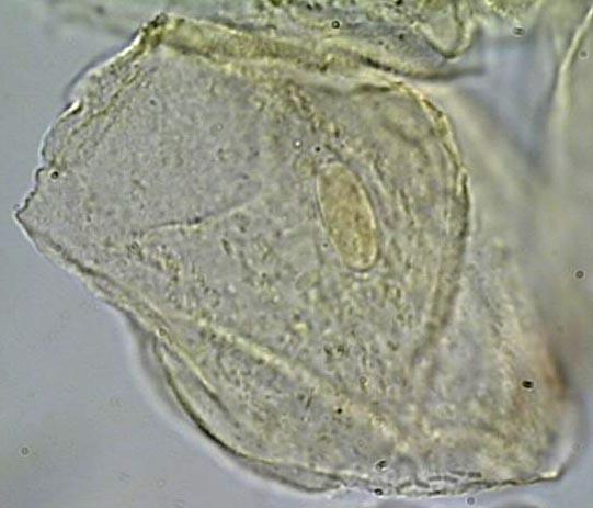 Biology Microscopy - Organelles | The Ohio State University